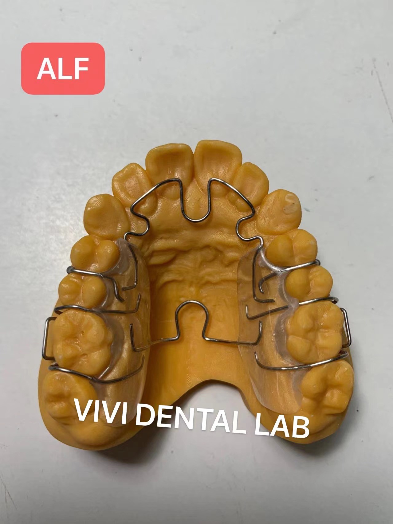 Removable Teeth Alignment Correction ALF Alternative Lightwire Functional