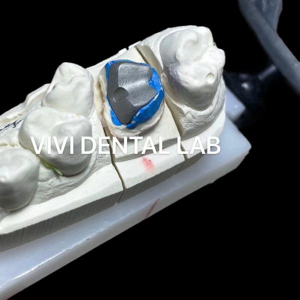 Dental Metal Post And Core Crown co cr Accurate Retentive