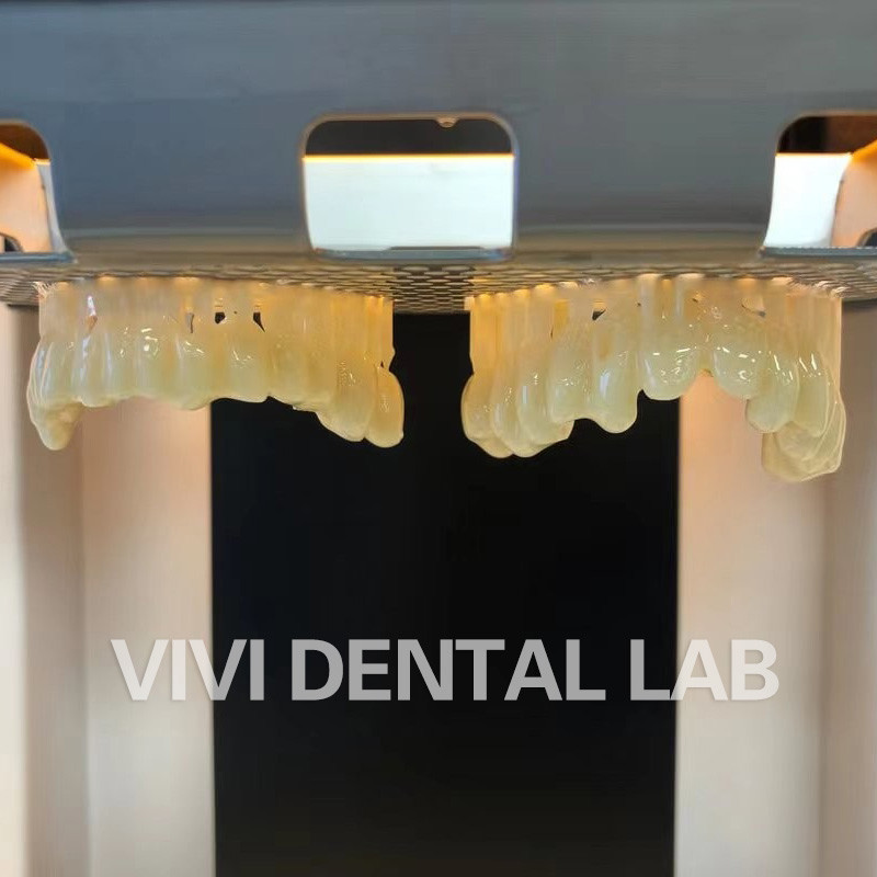 Provisional Shell Dental Lab Crowns Teeth PMMA Temporary Crown