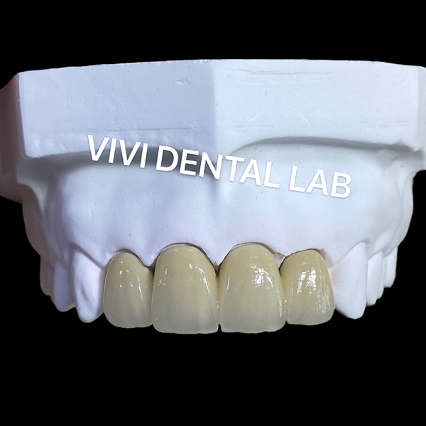 PFM Dental Lab Crowns SLM Technique With Scheftner 30 Alloy Powder