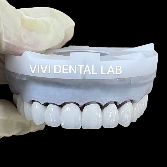 Super White Zirconia Dental Lab Crowns 3D PRO PFZ Noritake Porcelain