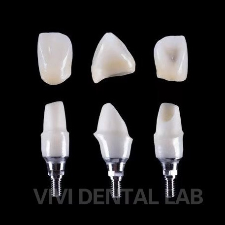 Dental Implant Tibase Zirconia Abutment Titanium Accuracy Customized