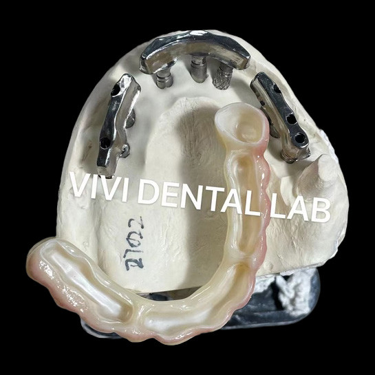 Titanium Full Zirconia Bridge Dental Translucency On Implant Bar