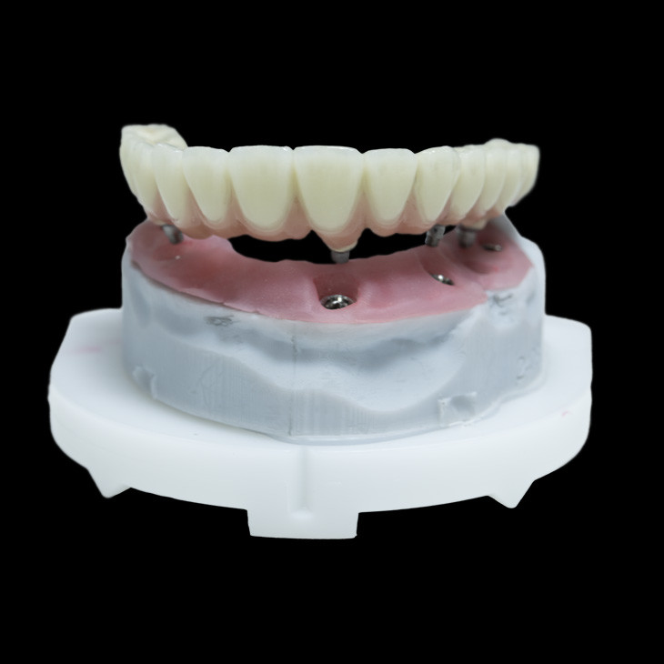 All On 4 PFM Dental Implant Crown Titanium Zirconia All On 6 Restorations