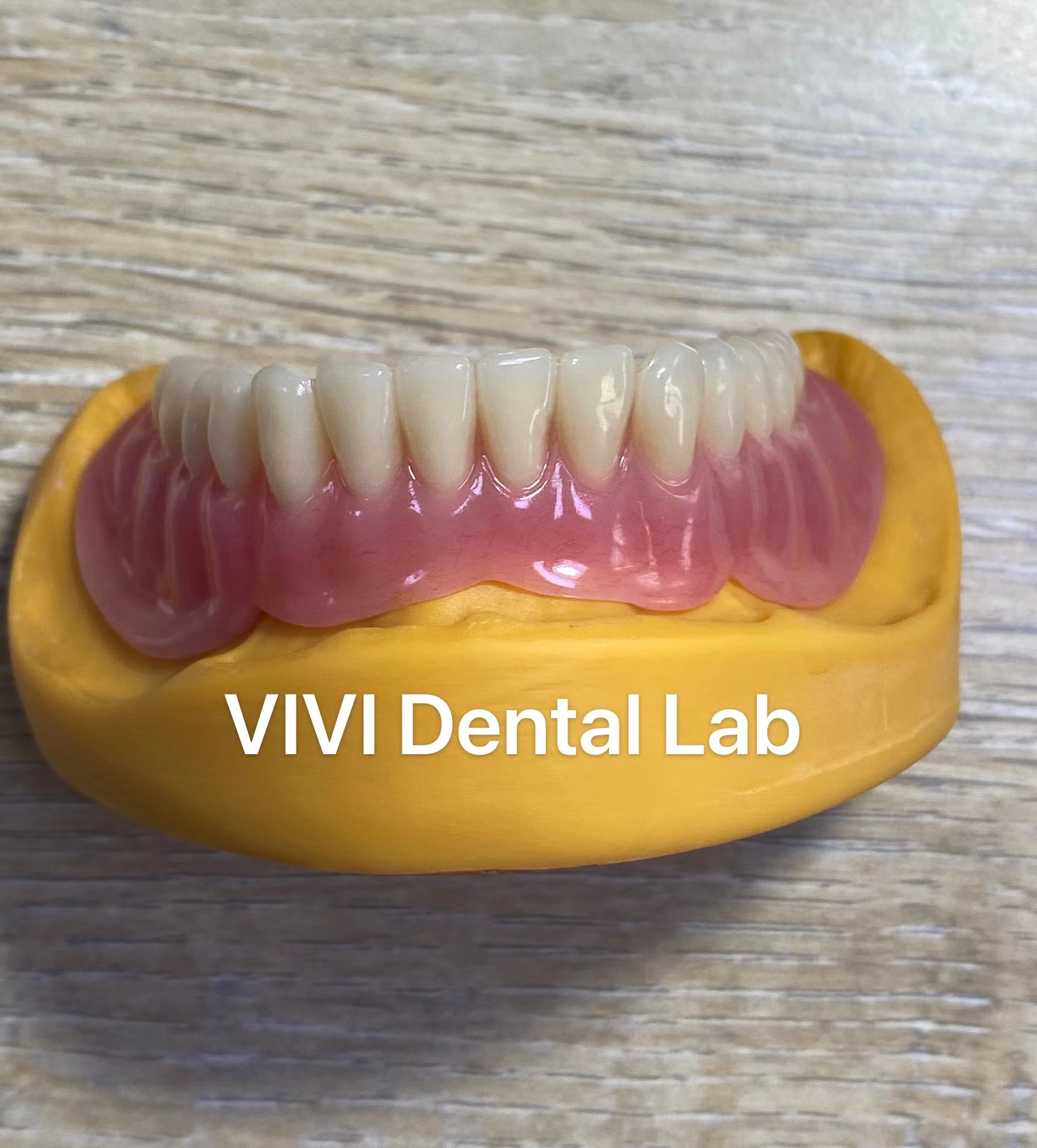 High Esthetics Full Acrylic Denture Teeth Designed And Milled