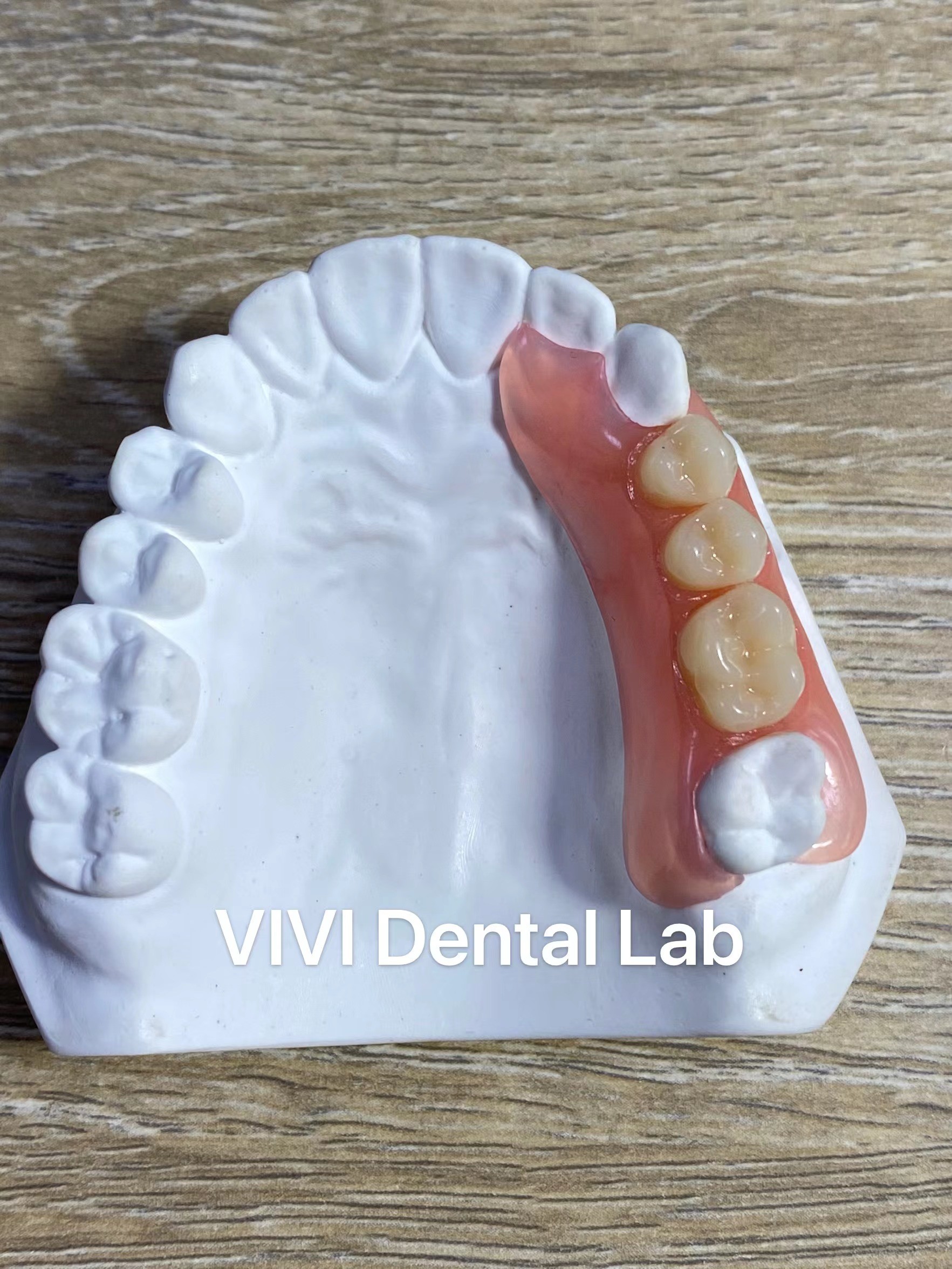 High Esthetics Flexible Acrylic Partial Denture / Valplast Dental Partials
