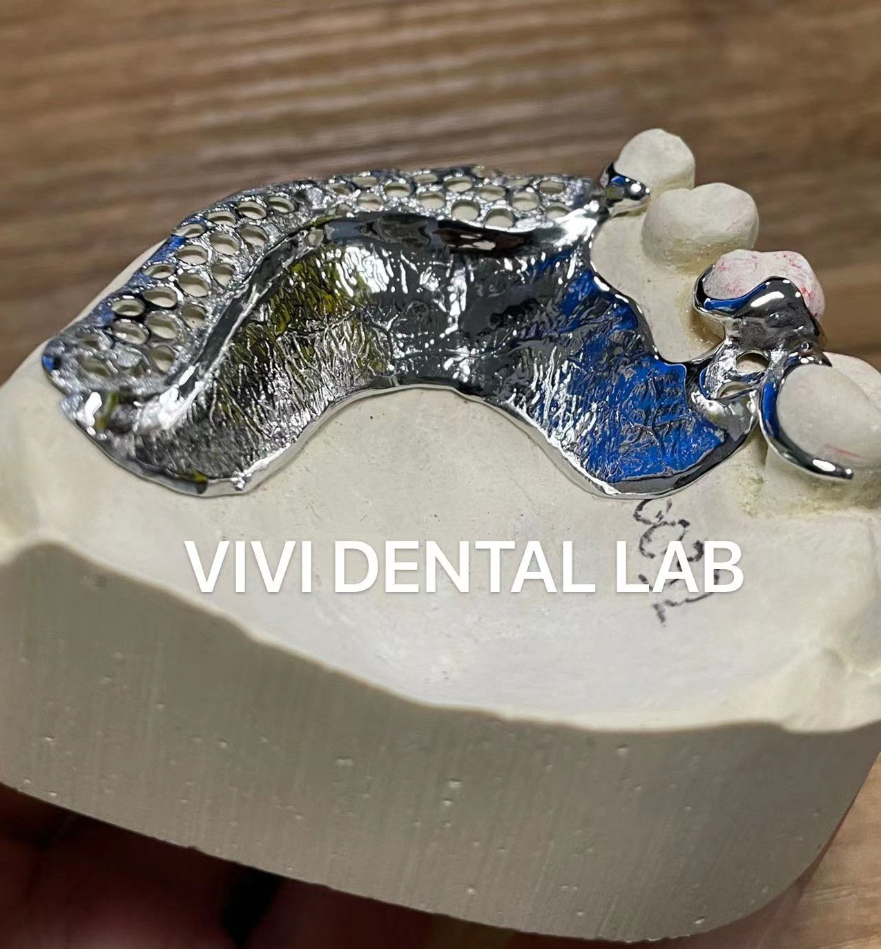 Laser Printing Cobalt Chrome Partial Denture Framework Ni Be Free