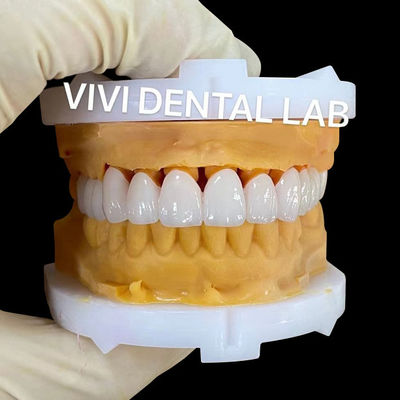 Dental Crown and Bridge on sales of page 3 - Quality Dental Crown and ...