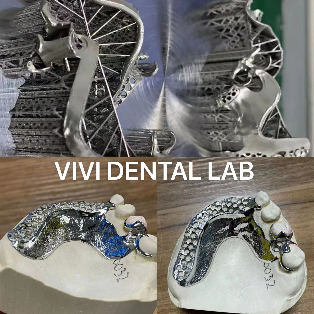 Laser Printing Cobalt Chrome Partial Denture Framework Ni Be Free