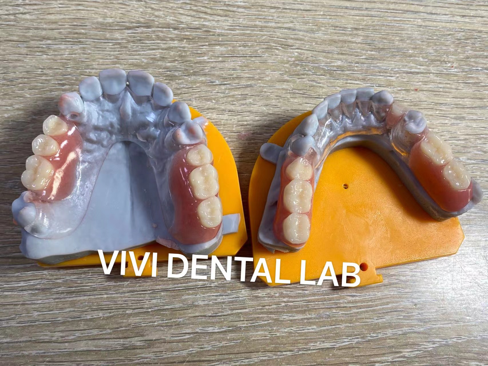 Flexible Clear Metal Partial Denture Frameworks High Esthetics