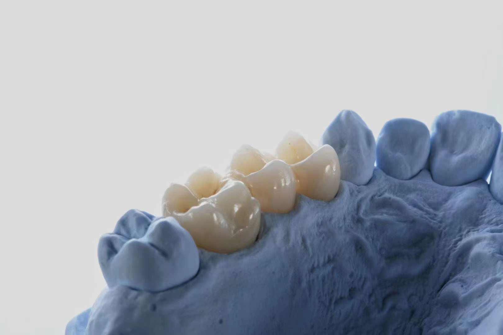 Full Contour Dental Lab Crowns High Translucency Solid Zirconia Crown