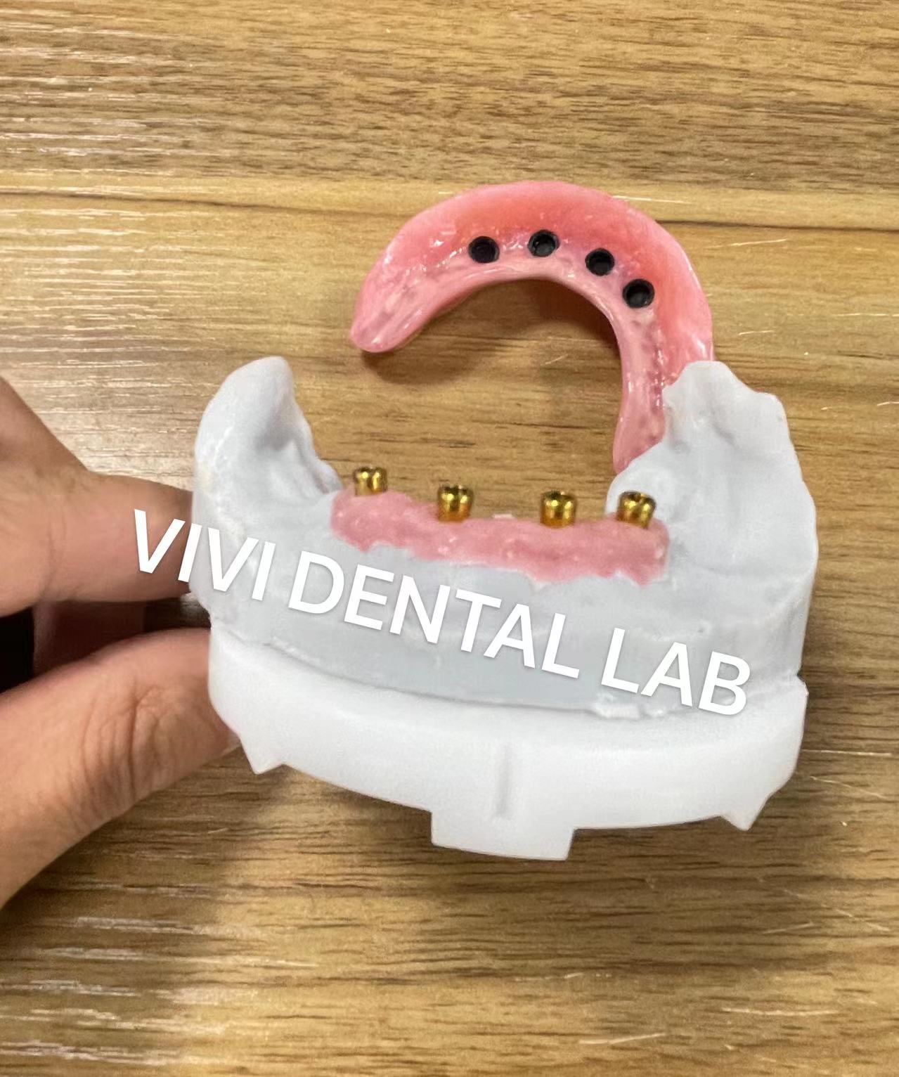 Retentive Ivoclar Full Acrylic Denture Teeth With Attachments