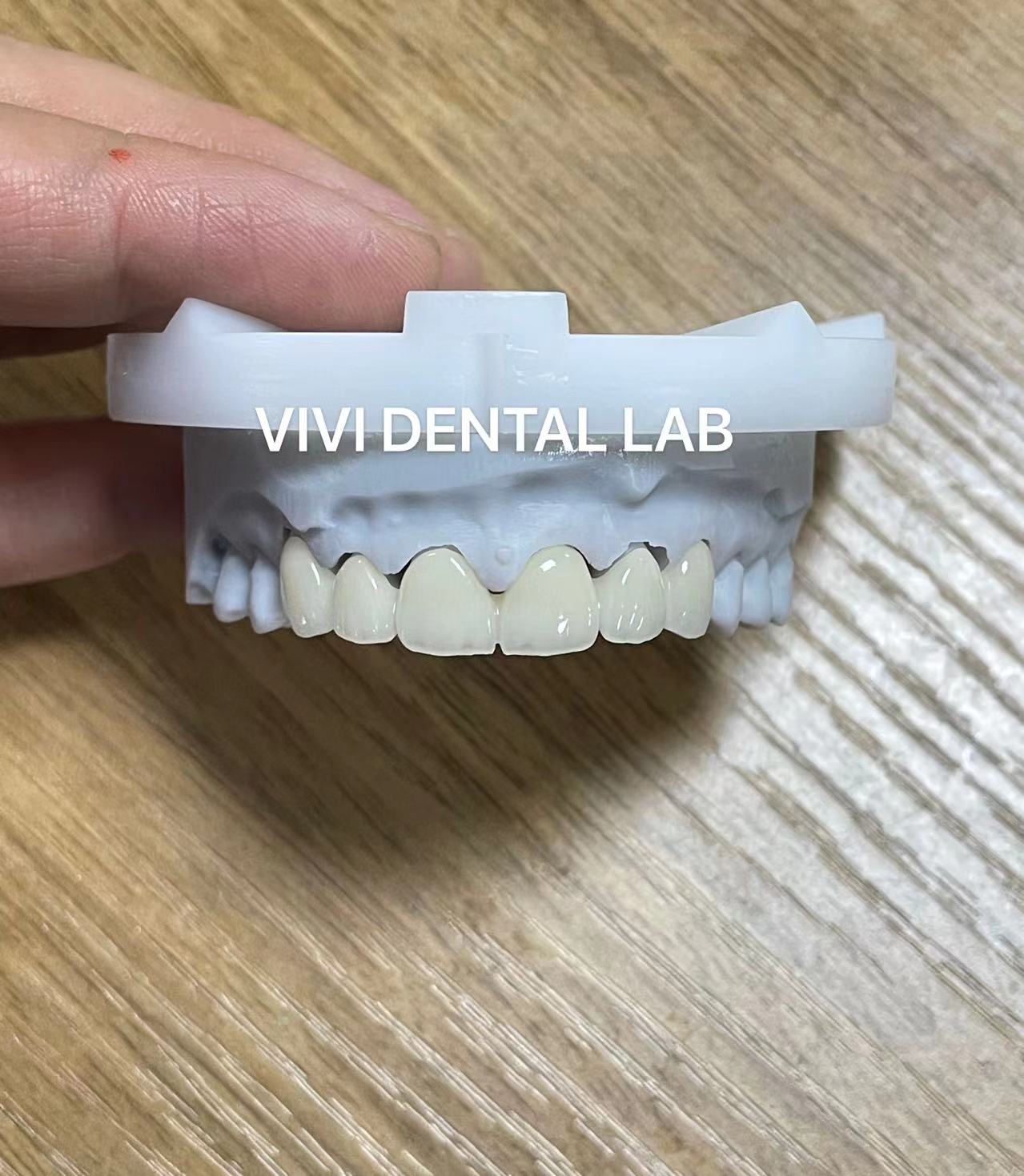 Layered Dental Zirconia Crown And Bridge Translucency 3D PRO