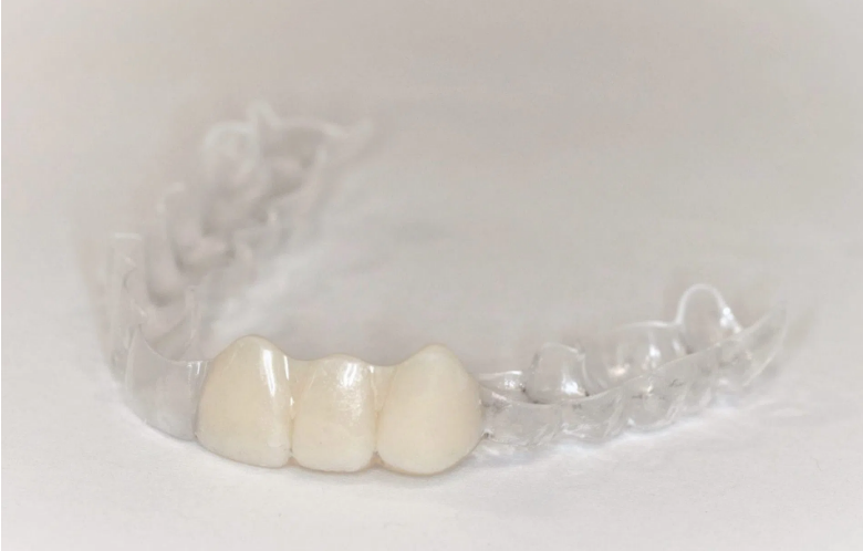 Dental Stable Teeth Orthodontic Retainer Professional Clear Essix Retainer